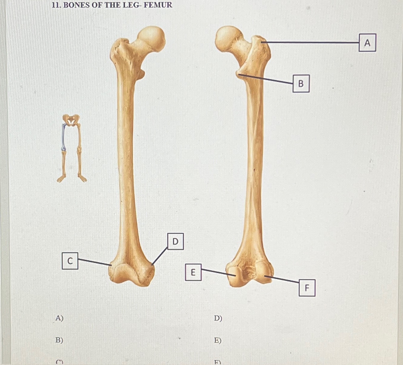 Solved BONES OF THE LEG- ﻿FEMUR | Chegg.com
