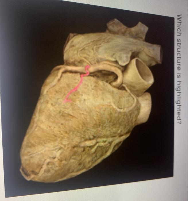 Solved Which structure is highlighted? left anterior | Chegg.com