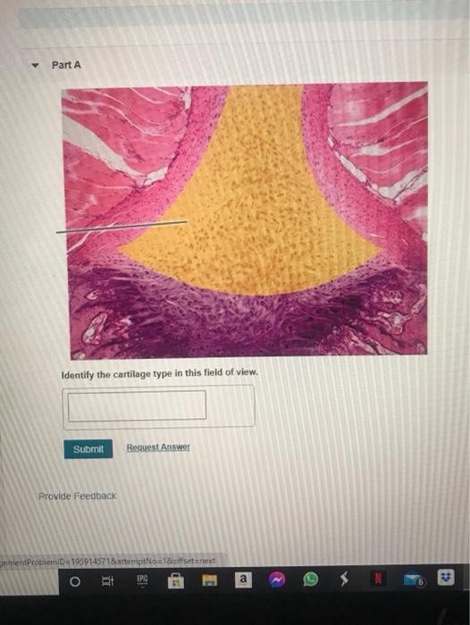 Solved Part A Identify the highlighted structure. striations | Chegg.com