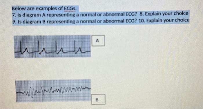 [Solved]: Below are examples of ECGs. 7. Is diagram A repre
