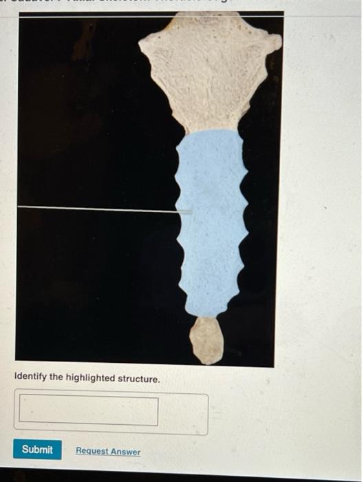 Solved Identify the highlighted structure. Submit Request | Chegg.com