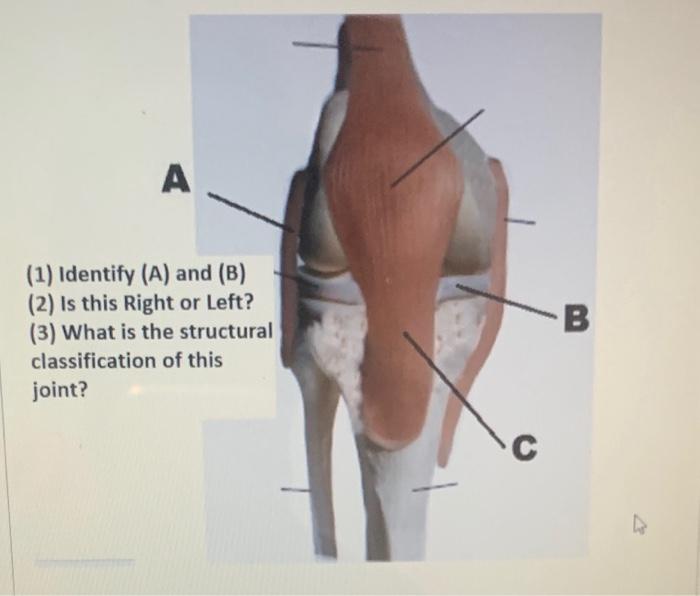 Solved Question 14 Id the bony landmarks indicated by the | Chegg.com