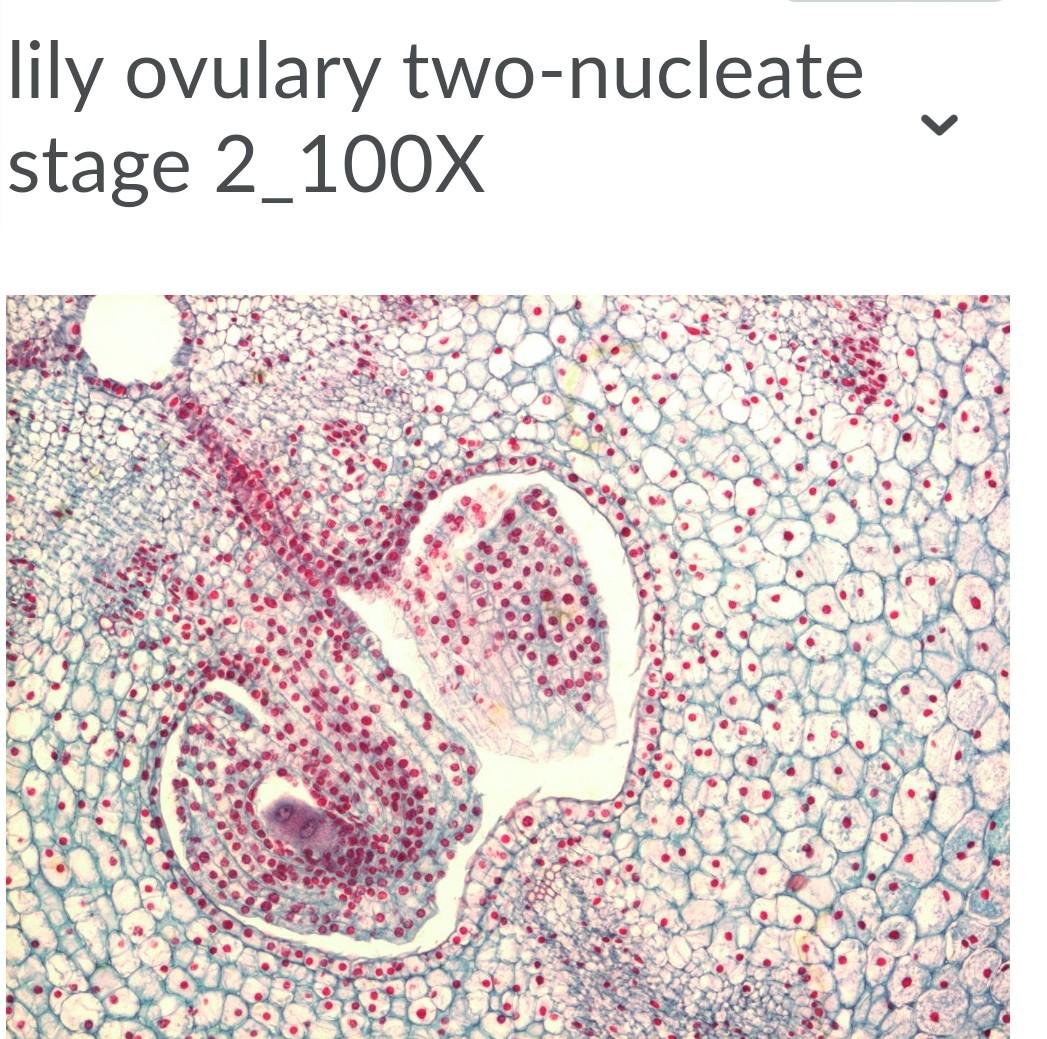 Solved lily ovulary two-nucleate stage_40X