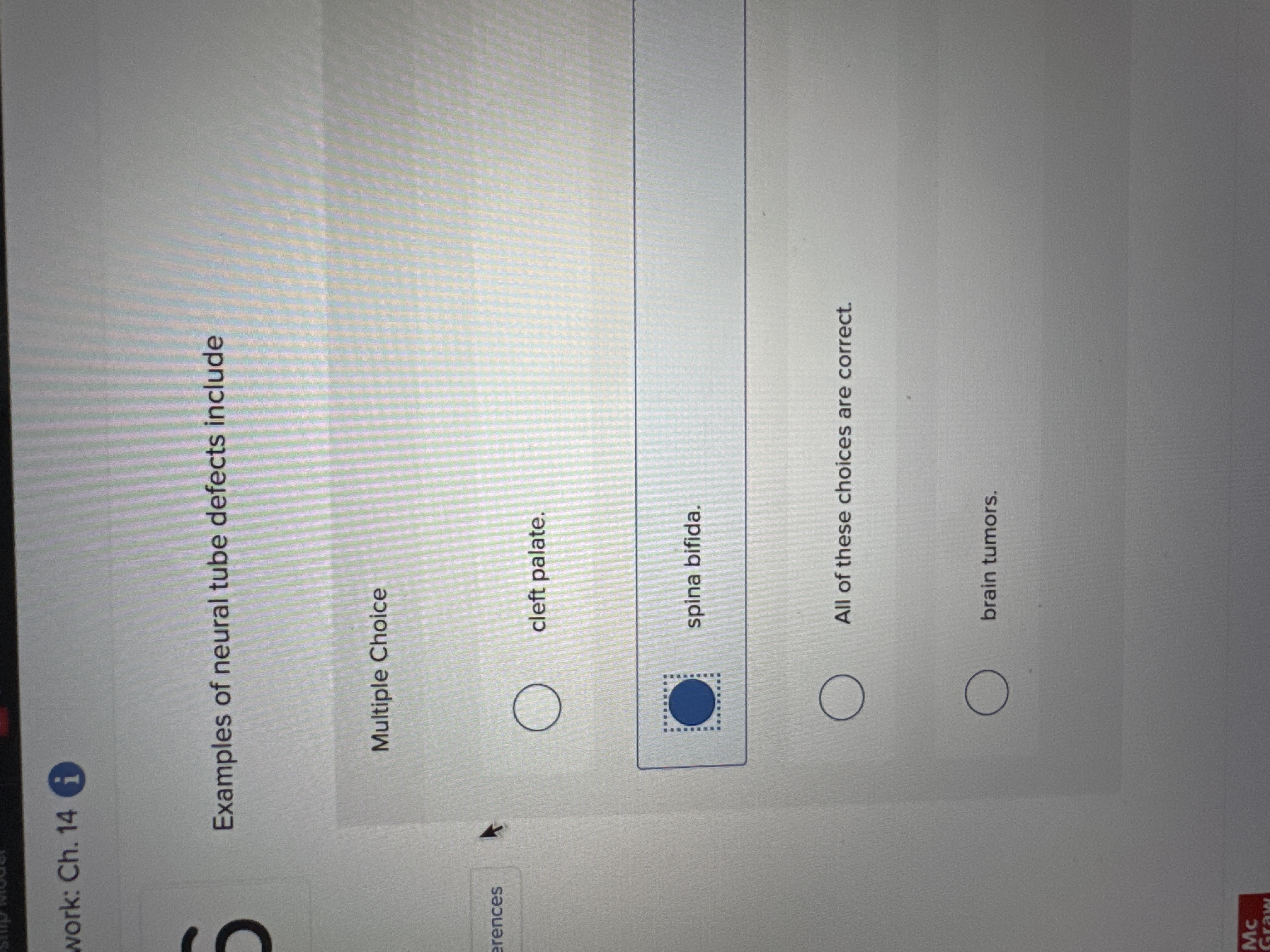 Solved Examples of neural tube defects includeMultiple | Chegg.com