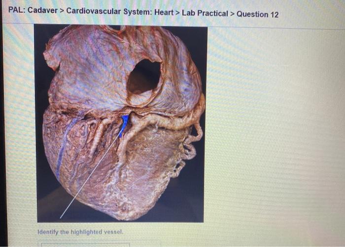Solved PAL: Cadaver > Cardiovascular System: Heart > Lab | Chegg.com
