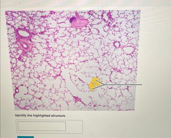 Solved Identify the highlighted structure. Identify the | Chegg.com