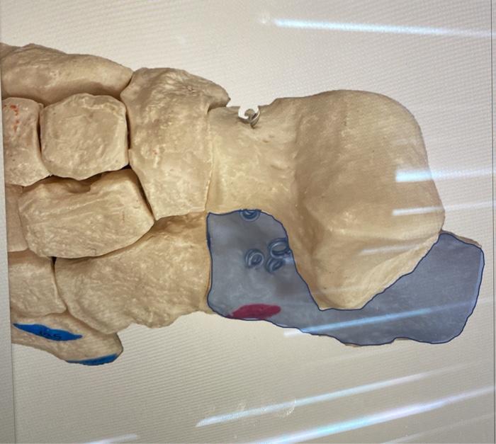 Solved Cuboid Lateral cuneiform Navicular Intermediate | Chegg.com