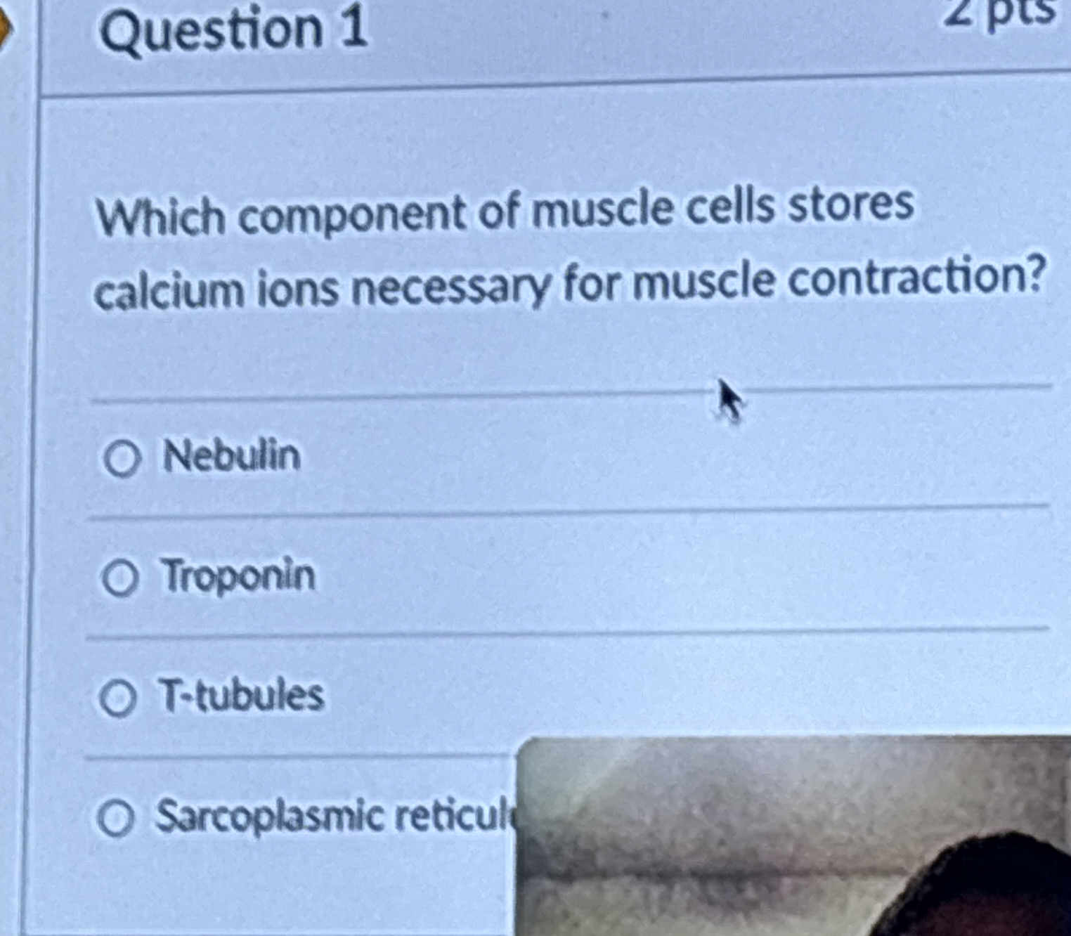 Solved Question 1Which component of muscle cells stores | Chegg.com