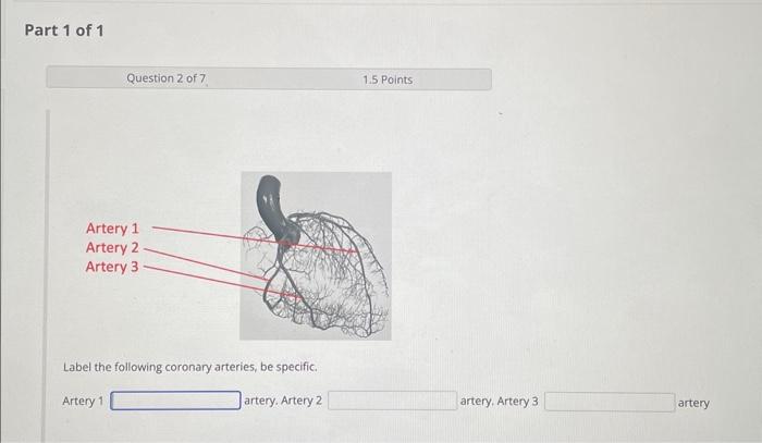 Solved Label the following coronary arteries, be specific. | Chegg.com