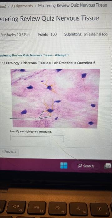 Solved astering Review Quiz Nervous Tissue - Attempt 1 L. | Chegg.com