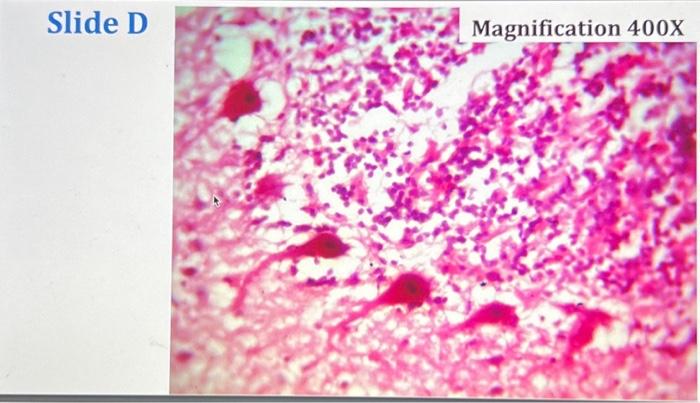 Solved Slide F Magnification 1000X Hint: this is not an | Chegg.com