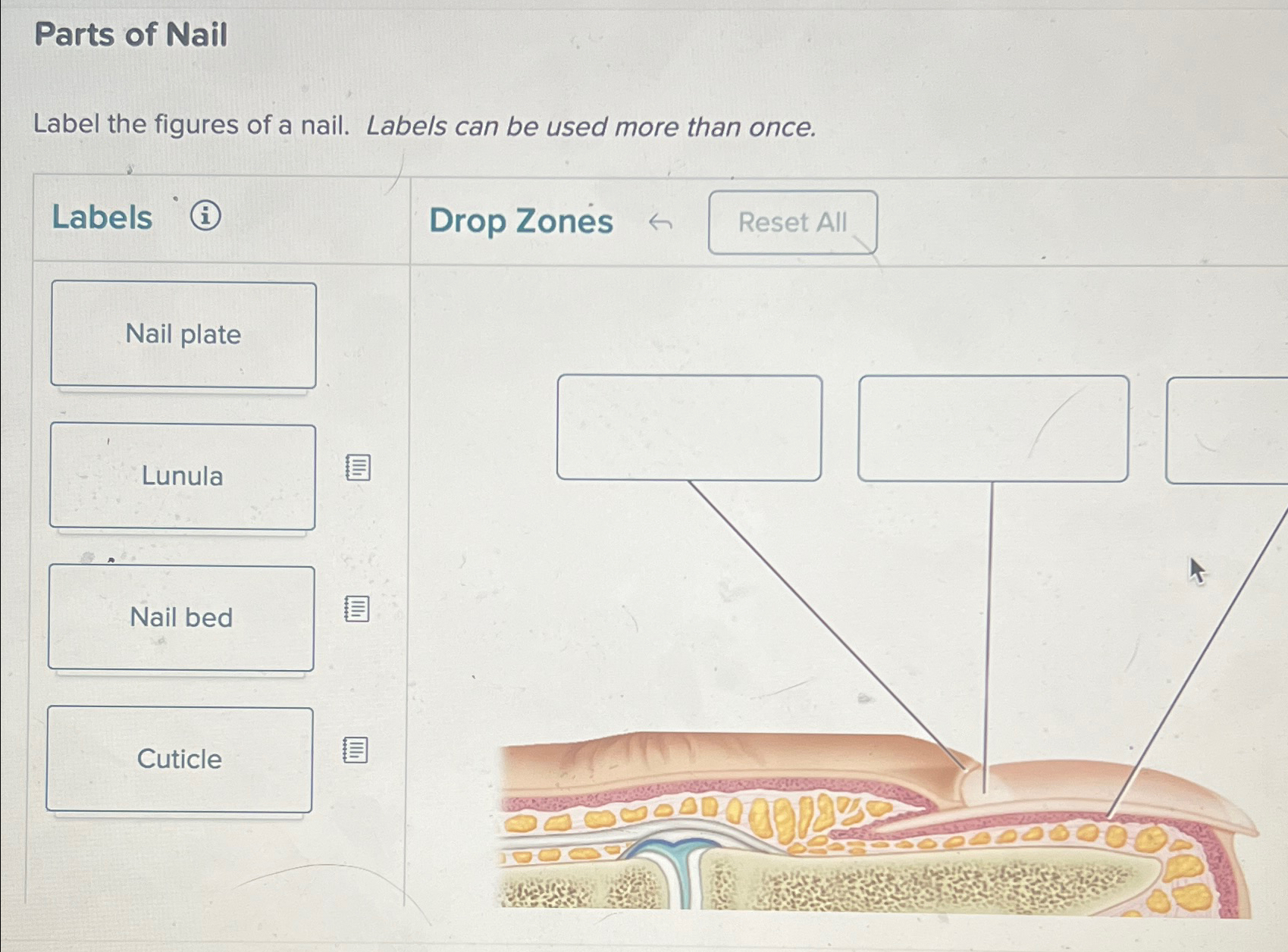 Solved Parts of NailLabel the figures of a nail. Labels can | Chegg.com