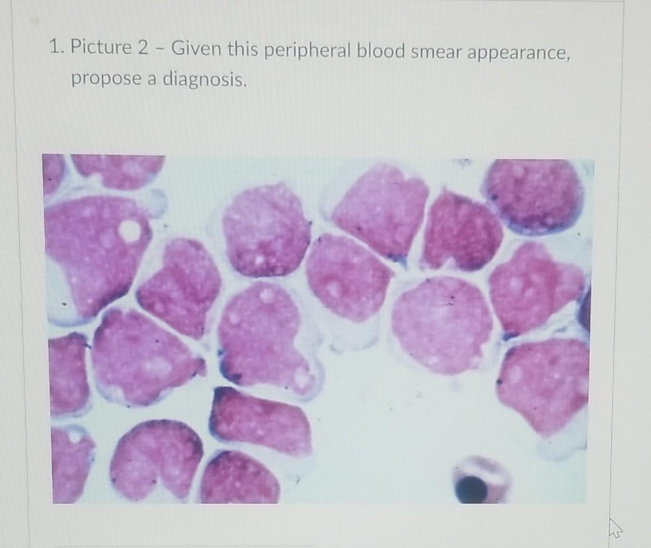 Solved 1. Picture 2 - Given this peripheral blood smear | Chegg.com