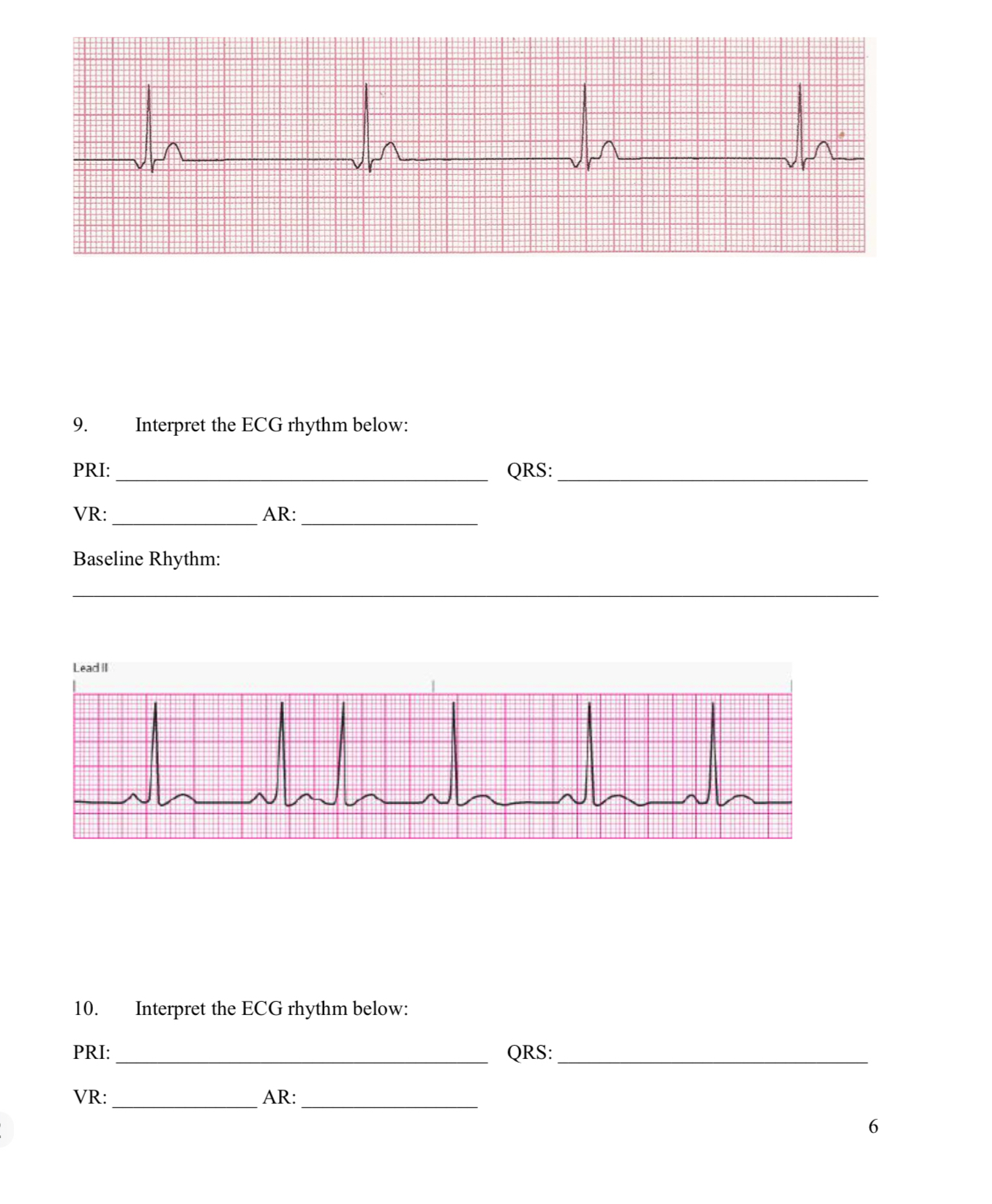 Solved 9. ﻿Interpret the ECG rhythm | Chegg.com