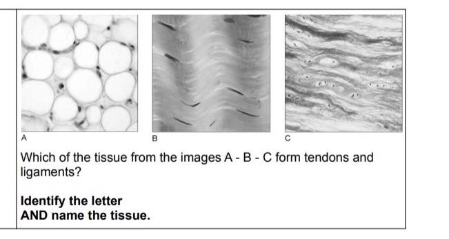 Solved B Which of the tissue from the images A - B - C form | Chegg.com