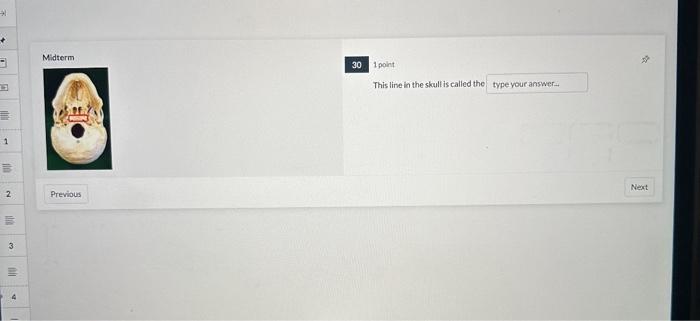 Solved Midterm 1 point This line in the skull is called the | Chegg.com
