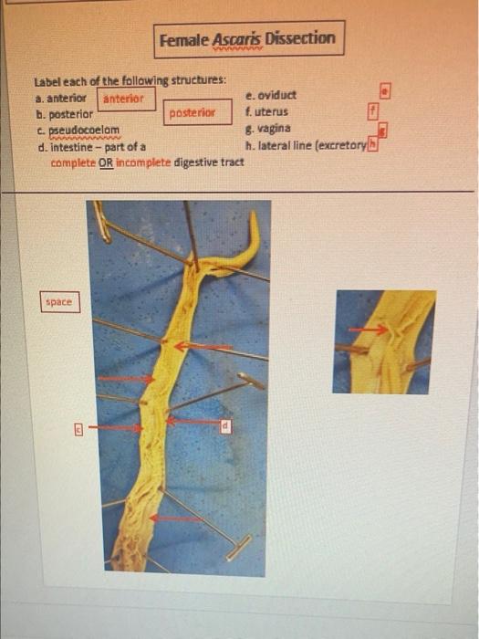 Female Ascaris Dissection WWW Label each of the | Chegg.com