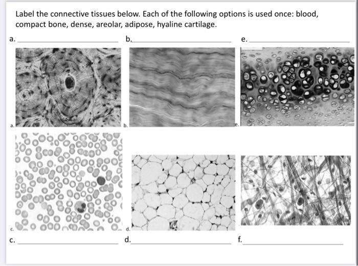 Solved Label the connective tissues below. Each of the | Chegg.com