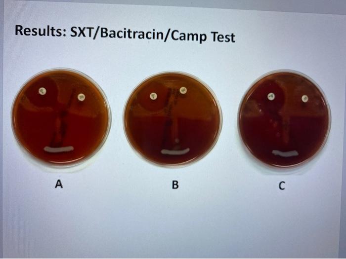 Solved Results: SXT/Bacitracin/Camp Test А B C | Chegg.com