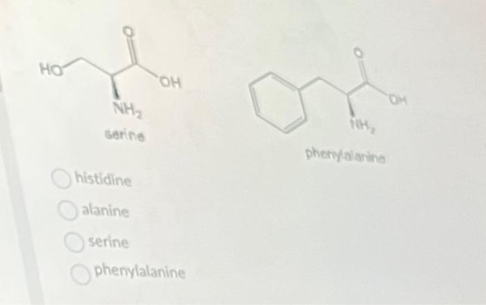 Solved Consider The Side Chains Of The Following Amino