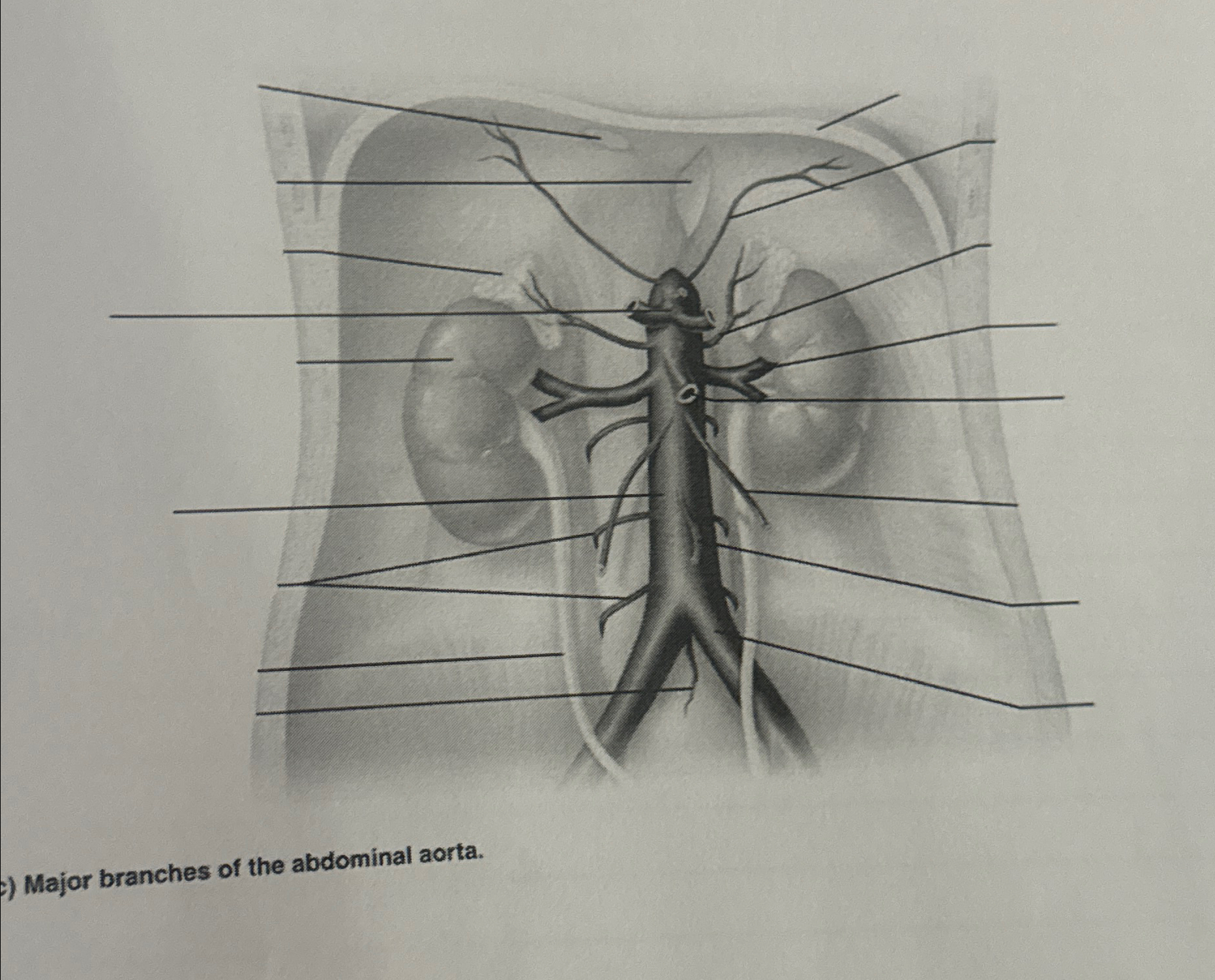 Solved Please lable all sections c) ﻿Major branches of the | Chegg.com