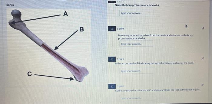 Solved Name the bony protruberance labeled A. 1 peint Name | Chegg.com