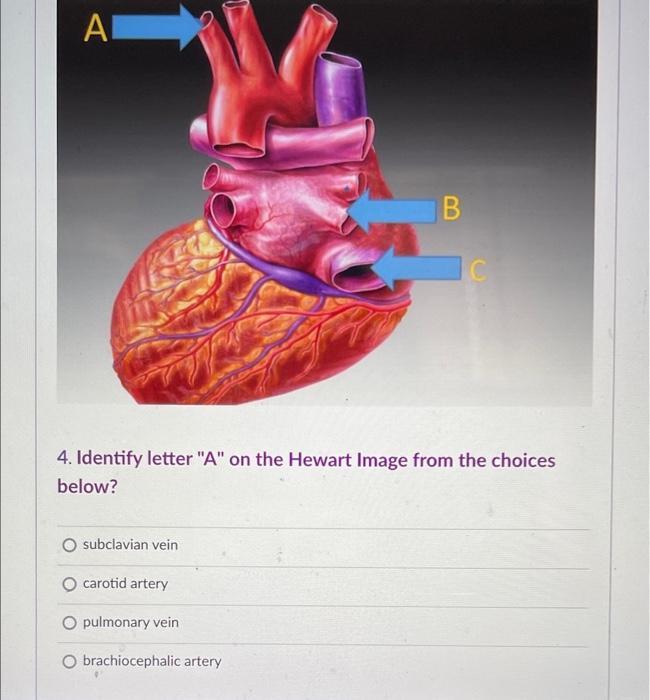 Solved ΑΙ B 4. Identify letter "A" on the Hewart Image from | Chegg.com
