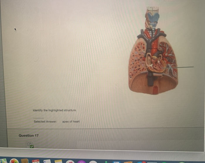 Solved Identify the highlighted structure Selected Answer: | Chegg.com