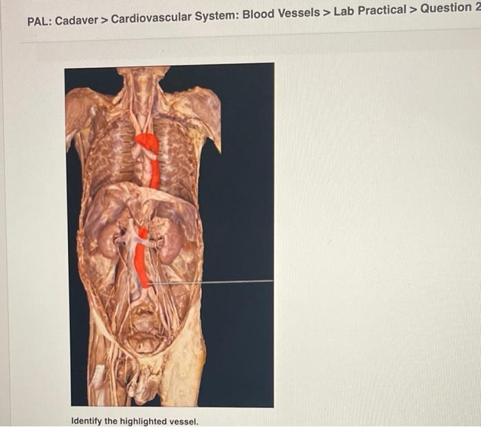 Solved PAL: Cadaver > Cardiovascular System: Blood Vessels > | Chegg.com