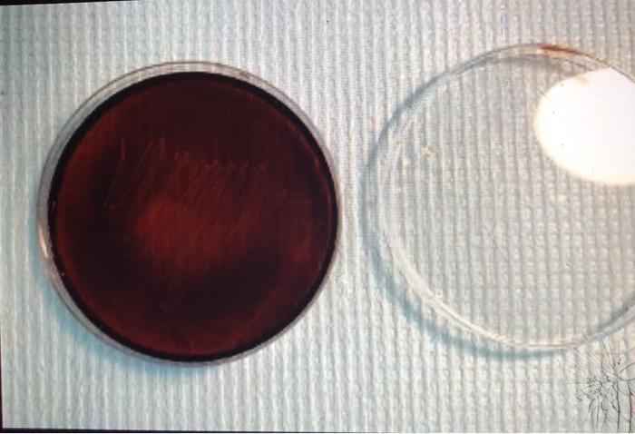 Solved Starch agar - uninoculated controlStarch agar after | Chegg.com