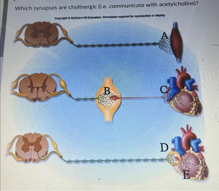 Solved Question 6 (1 point) In the diagram below the tract | Chegg.com