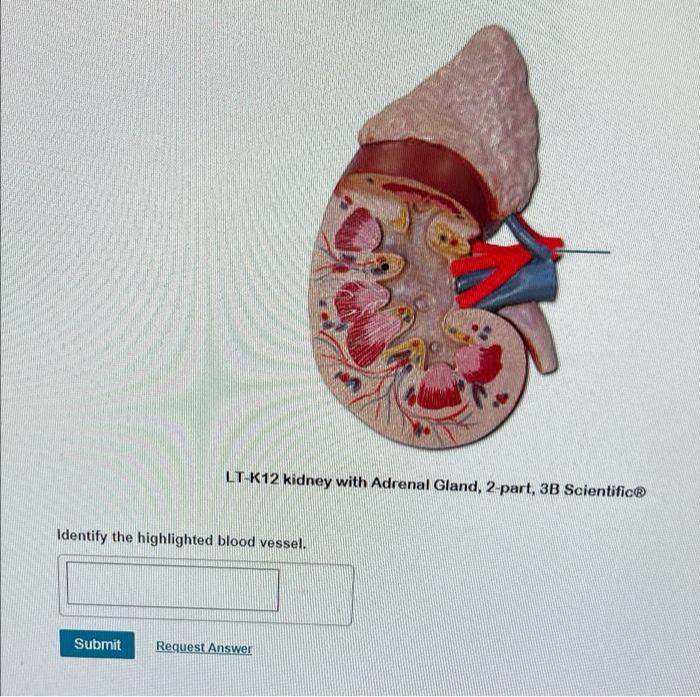 Solved Identify the highlighted vessel. From LT-VA10 | Chegg.com