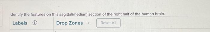 Solved Identify the features on this sagittal (median) | Chegg.com