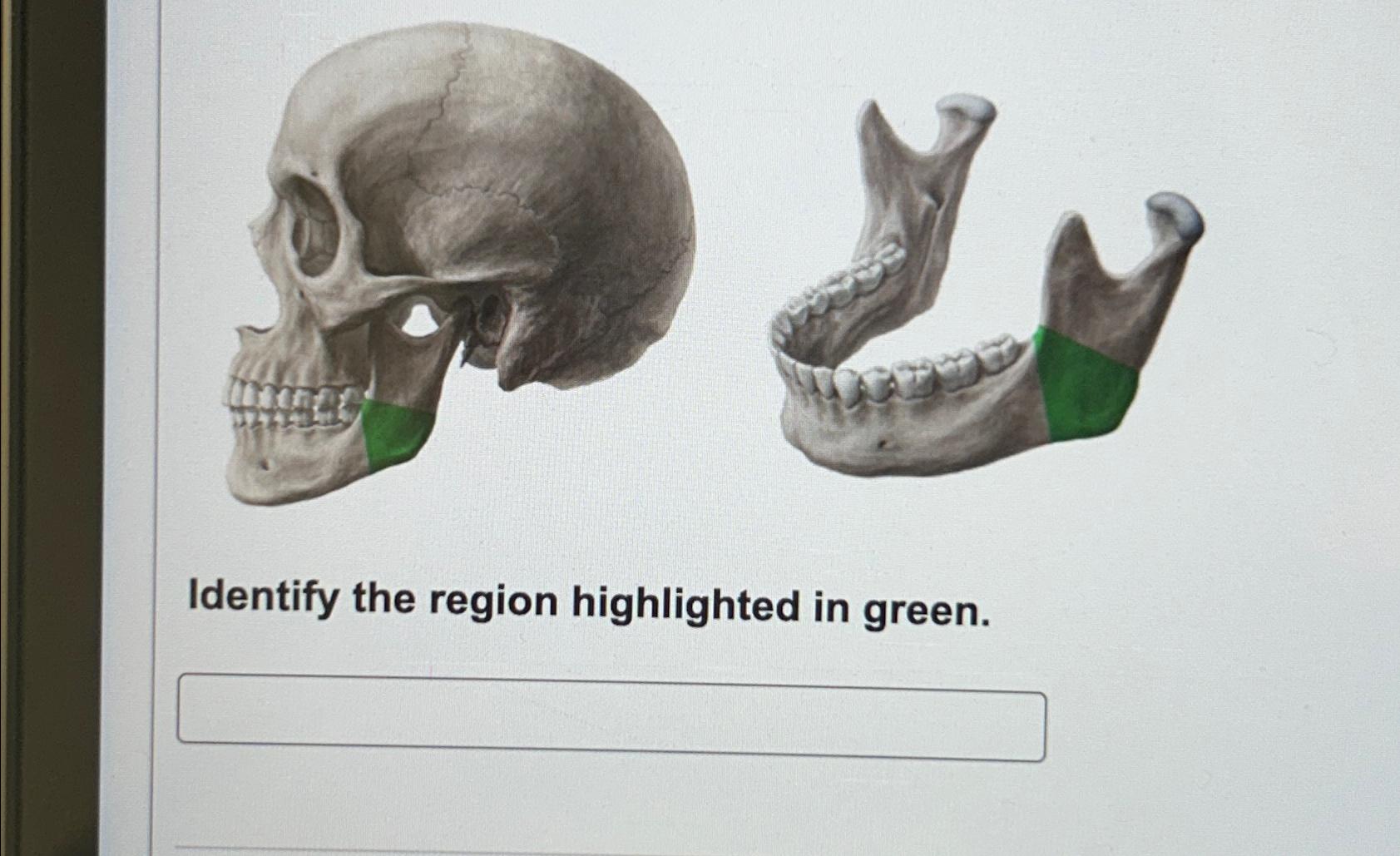 Solved Identify the region highlighted in green. | Chegg.com