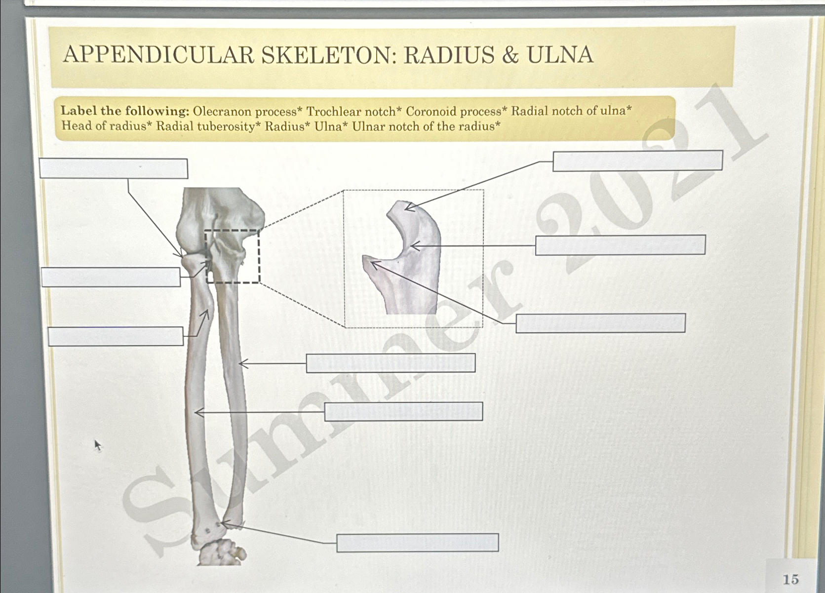 Solved APPENDICULAR SKELETON: RADIUS & ULNALabel the | Chegg.com