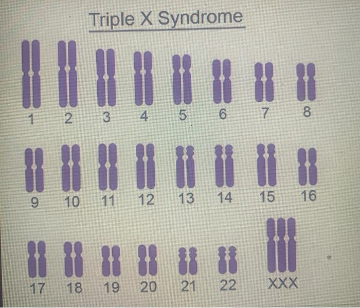 Triple X Syndrome