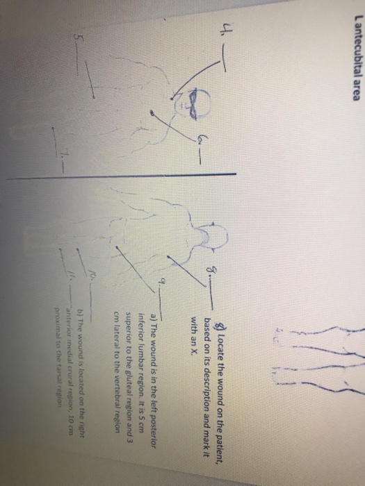 Solved Lantecubital area 4 6. ___ $) Locate the wound on the | Chegg.com