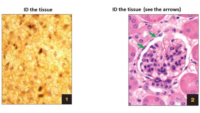 Solved ID the tissue ID the tissue (see the arrows) 1 2 | Chegg.com
