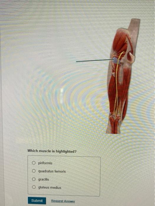 Solved Which muscle is highlighted? O piriformis O quadratus | Chegg.com