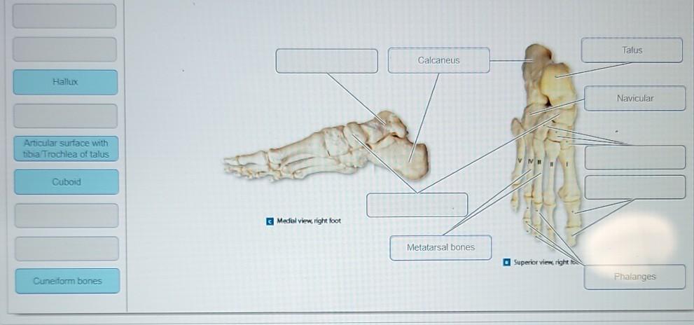 Solved Talus Calcaneus Hallur Navicular Articular surface | Chegg.com