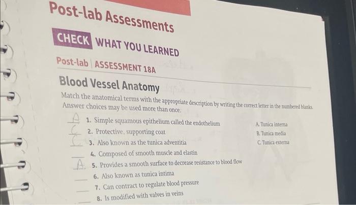 Solved Post-lab ASSESSMENT 188 Major Arteries and Veins | Chegg.com