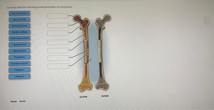 Classify the following images of bone into the | Chegg.com