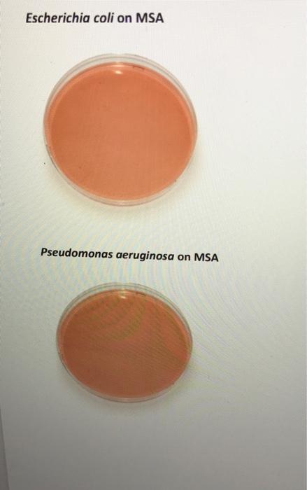 Solved Results A: Staphylococcus aureus on MSA Micrococcus | Chegg.com