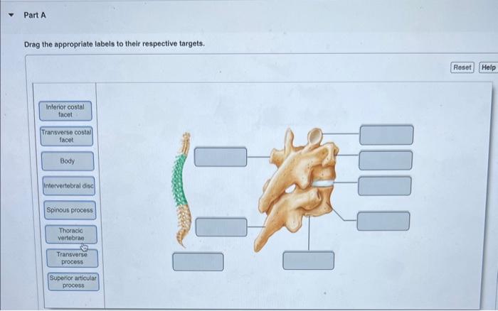 Solved Which part of a vertebra is known as the centrum? | Chegg.com