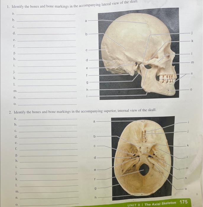 Solved 2. Identify the bones and bone markings in the | Chegg.com