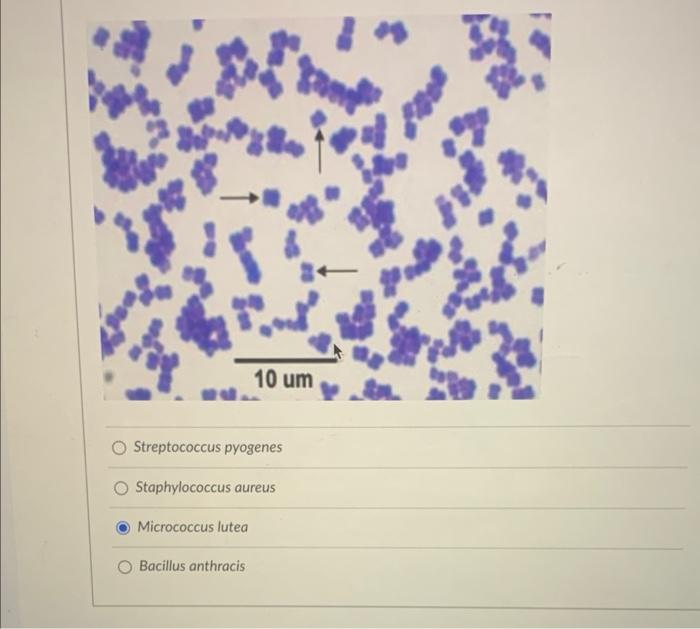 Solved Saccharomyces cerevisiae Staphylococcus aureus mold | Chegg.com