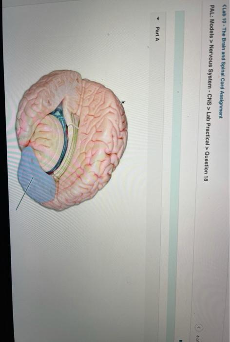 Solved Nervous System - CNS > Lab Practical > Question 18 | Chegg.com