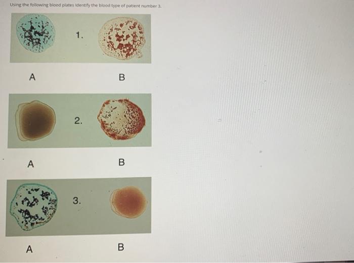 Solved Using the following blood plates identify the blood | Chegg.com