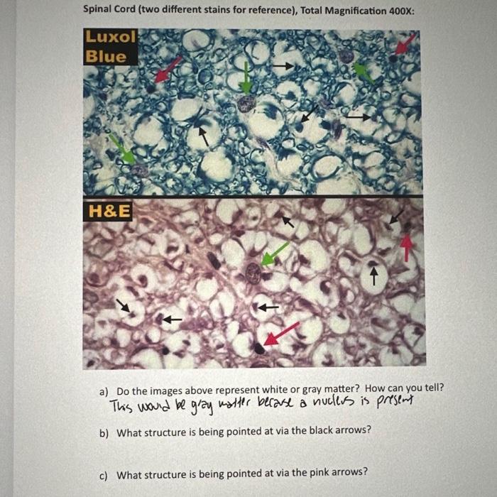 Solved Spinal Cord (two different stains for reference), | Chegg.com