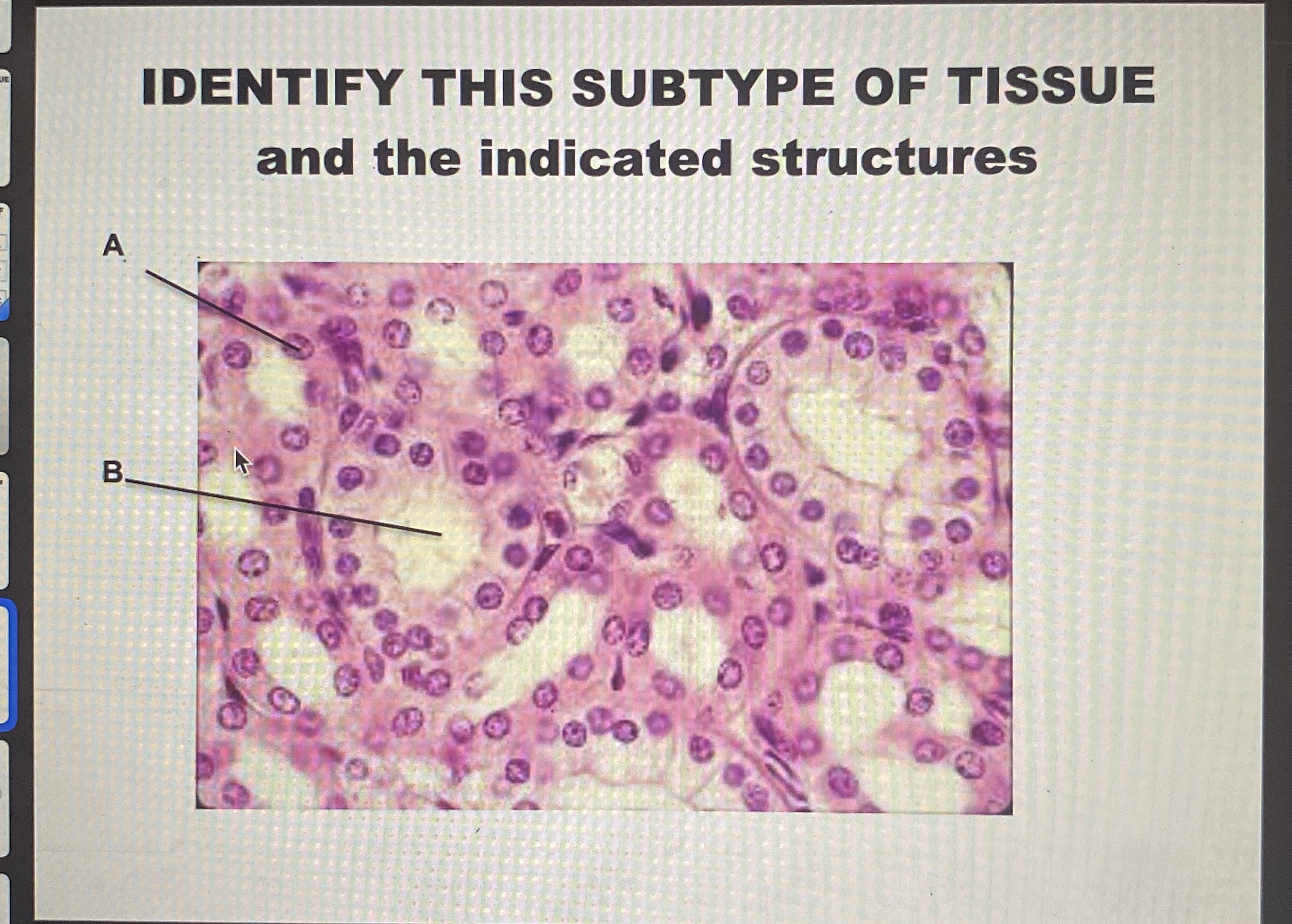 Solved IDENTIFY THIS SUBTYPE OF TISSUE and the indicated | Chegg.com